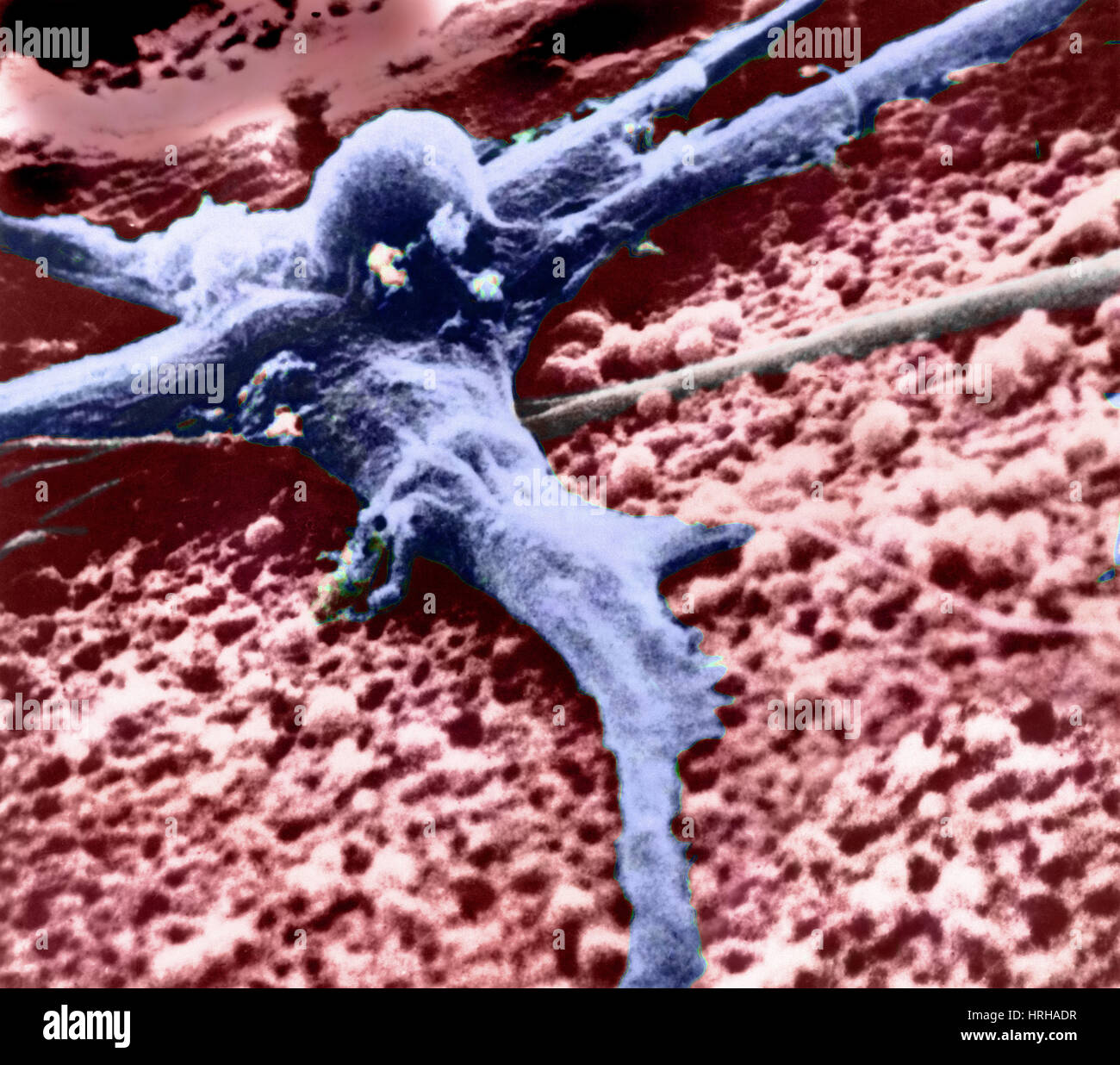 Malignant cancer cell Stock Photo - Alamy