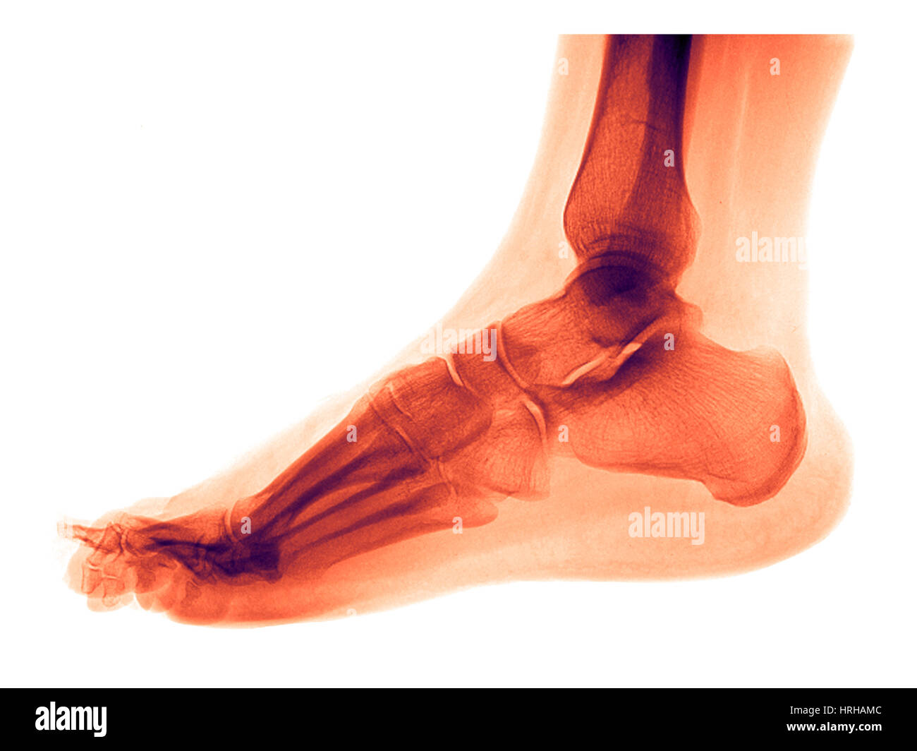 Medial Anatomy Foot Cut Out Stock Images & Pictures - Alamy