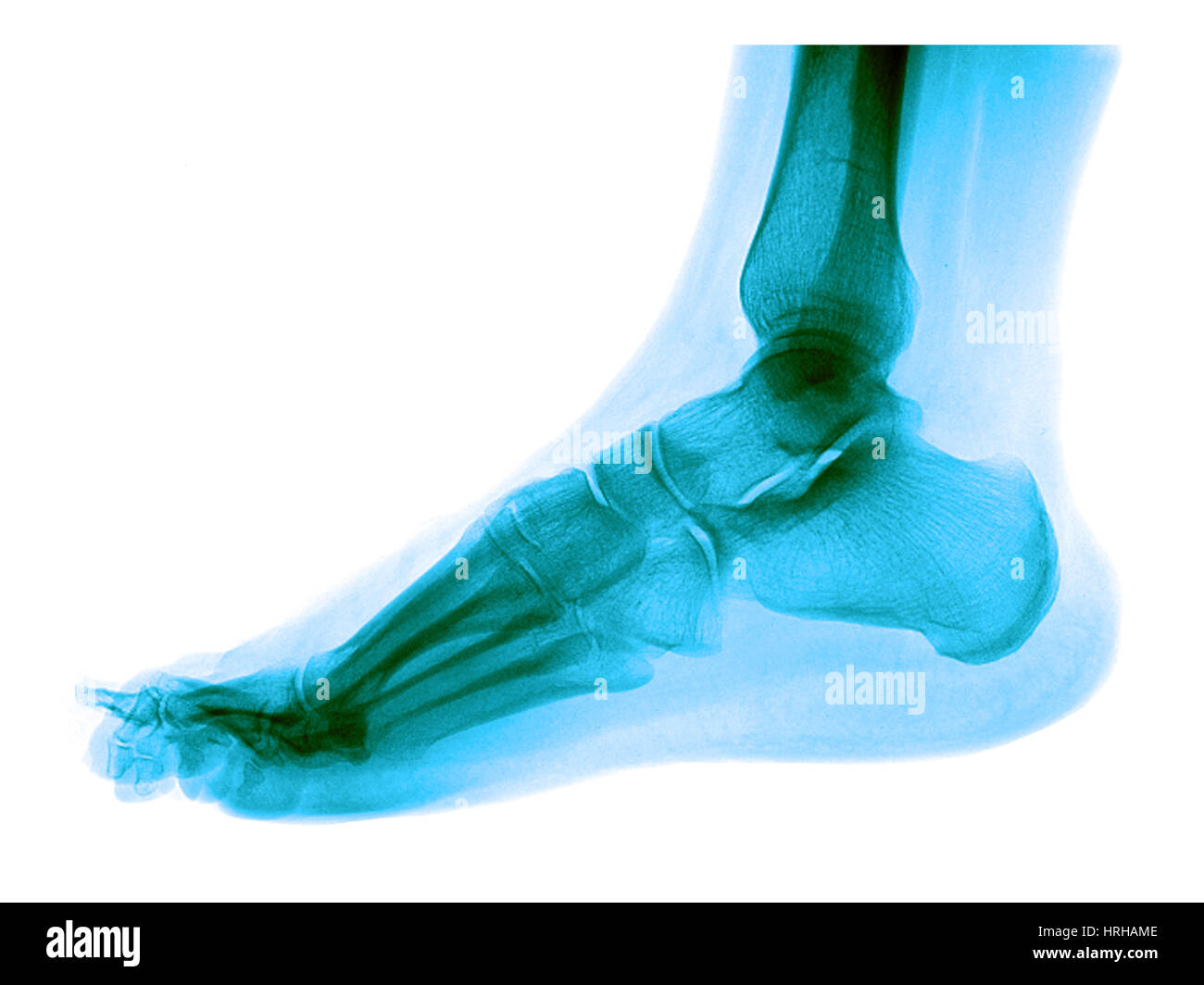Medial anatomy foot Cut Out Stock Images & Pictures - Alamy