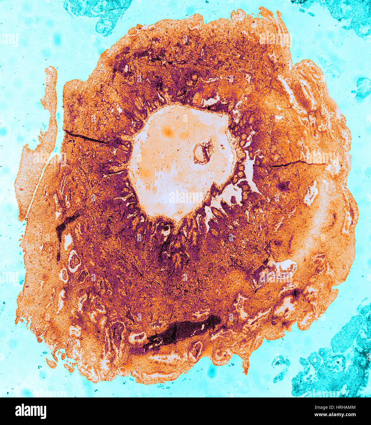 Fertilized egg micrograph human hi-res stock photography and images - Alamy