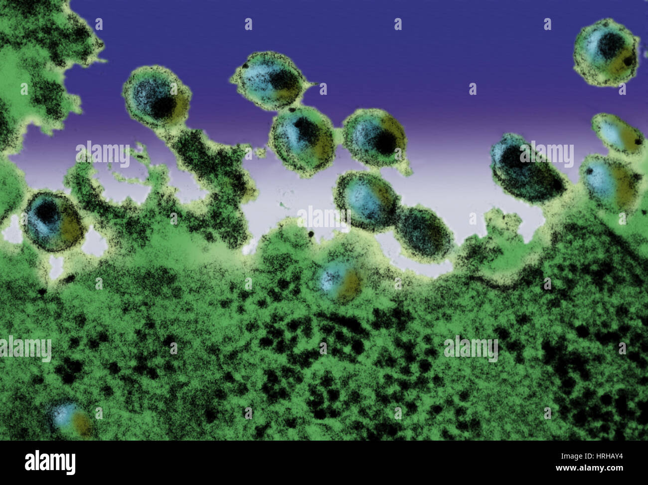 Human Immunodeficiency Virus Tem High Resolution Stock Photography and ...