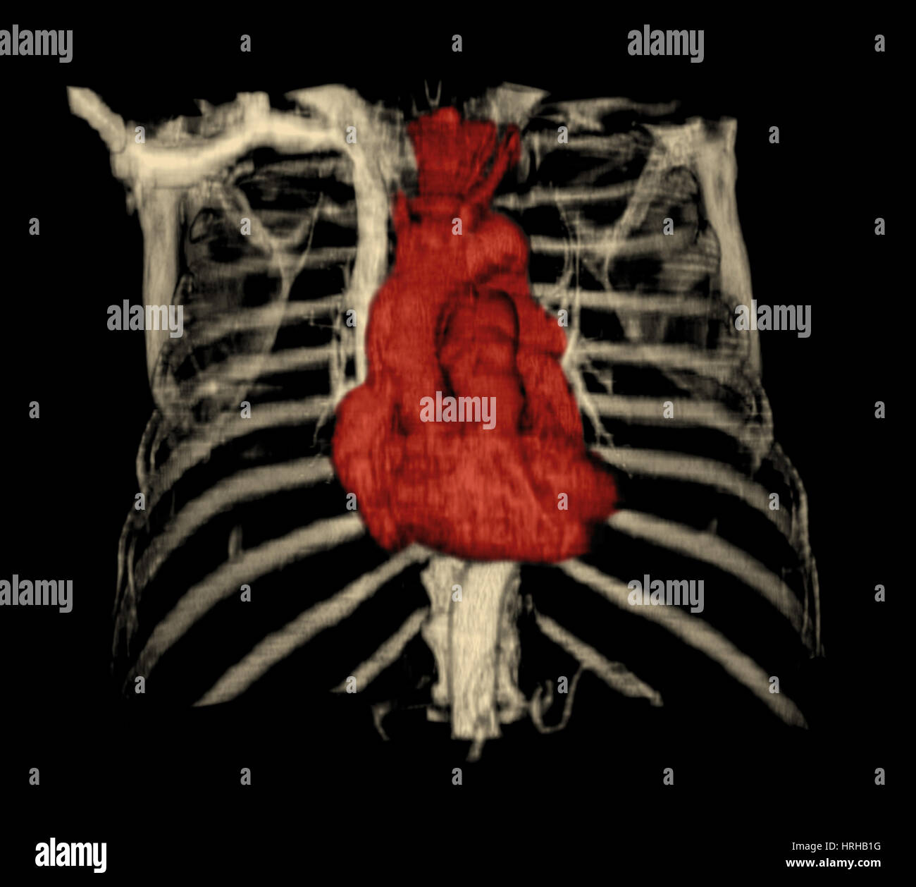 3D CT Reconstruction of Heart Stock Photo - Alamy