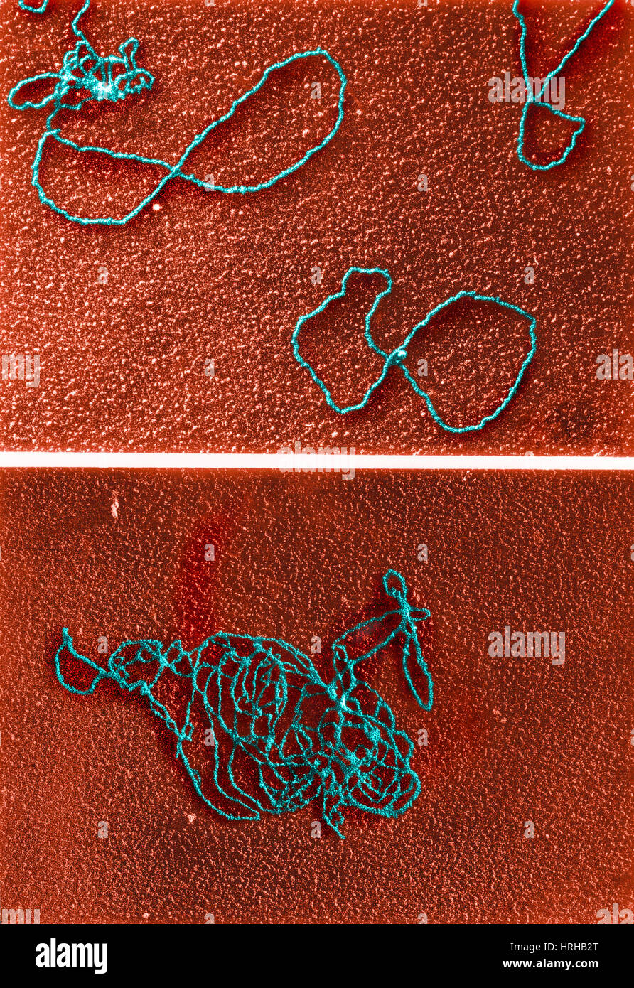 TEMs of DNA and Reaction Stock Photo - Alamy