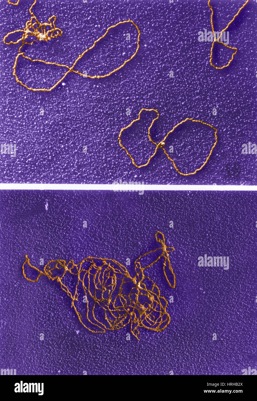 TEMs of DNA and Reaction Stock Photo - Alamy