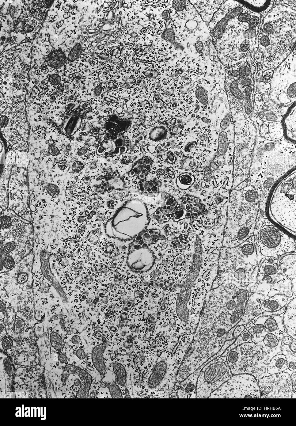 Transmission Electron Microscopy Black and White Stock Photos & Images ...