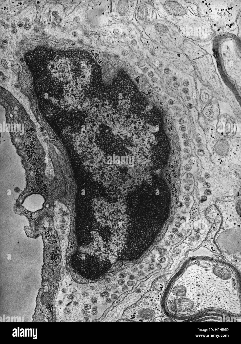 Roup C RNA Tumor Virus, TEM Stock Photo - Alamy