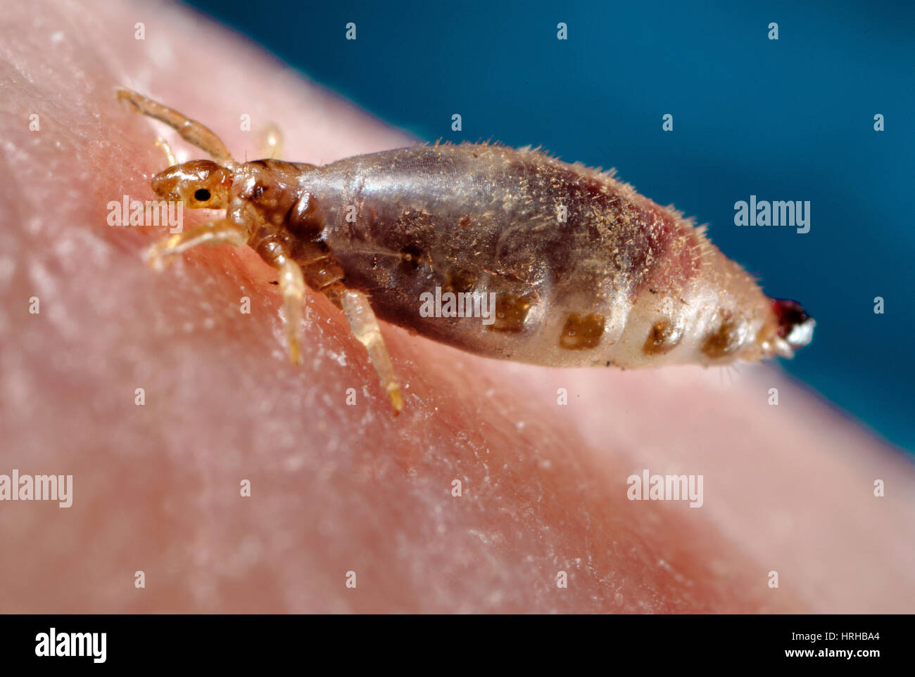 Body lice hi-res stock photography and images - Alamy