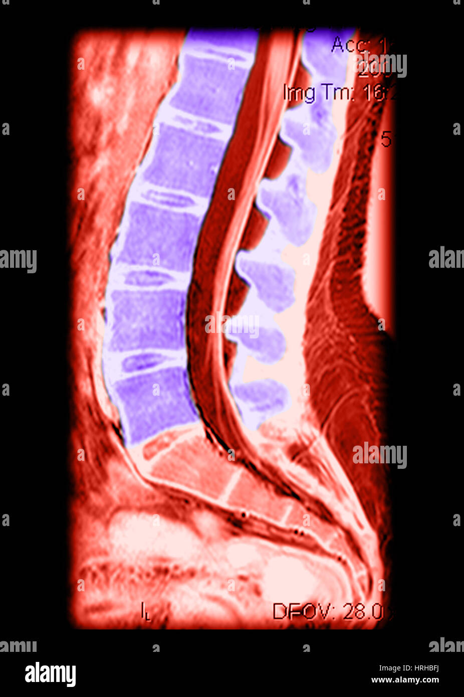Normal anatomy of lumbar spine hi-res stock photography and images - Alamy