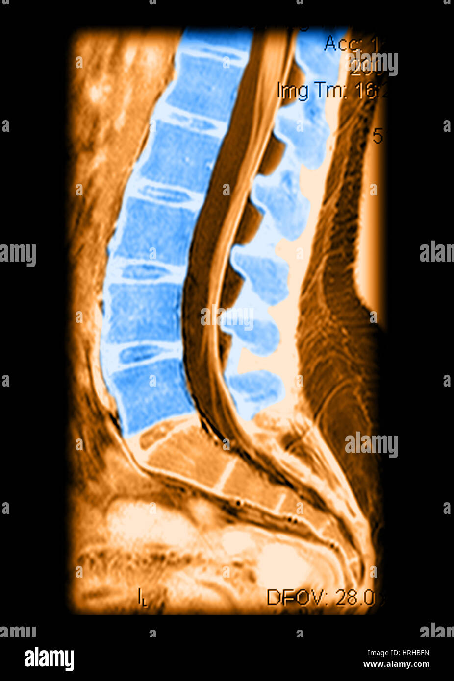 Normal anatomy of lumbar spine hi-res stock photography and images - Alamy