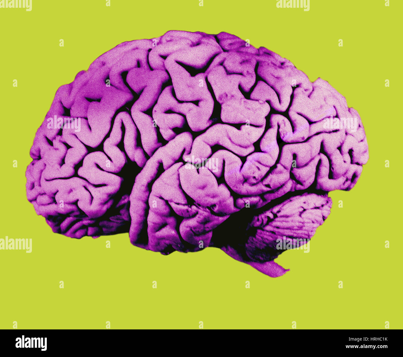 Brain human normal hi-res stock photography and images - Alamy