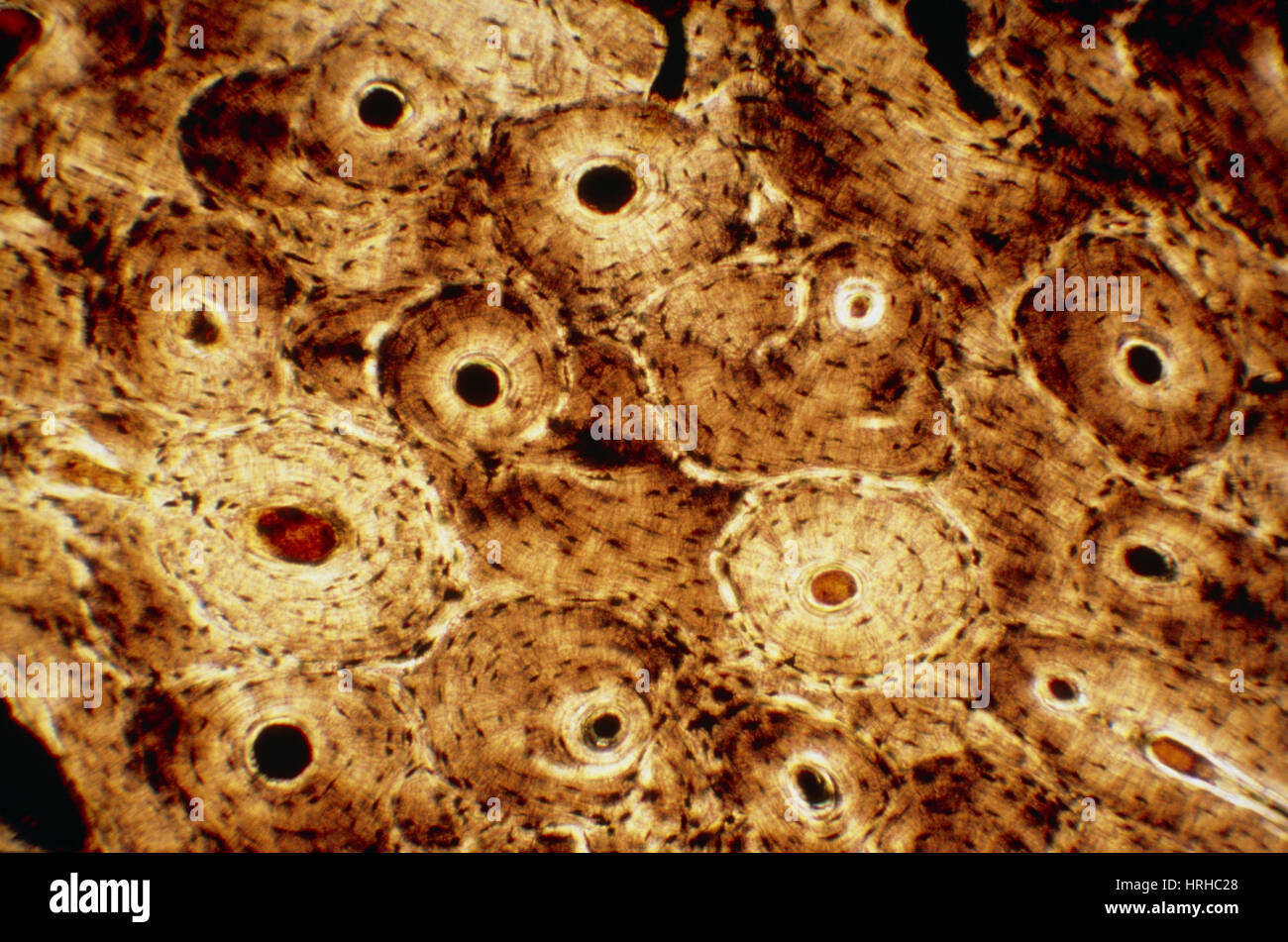 Human shin bone hi-res stock photography and images - Alamy