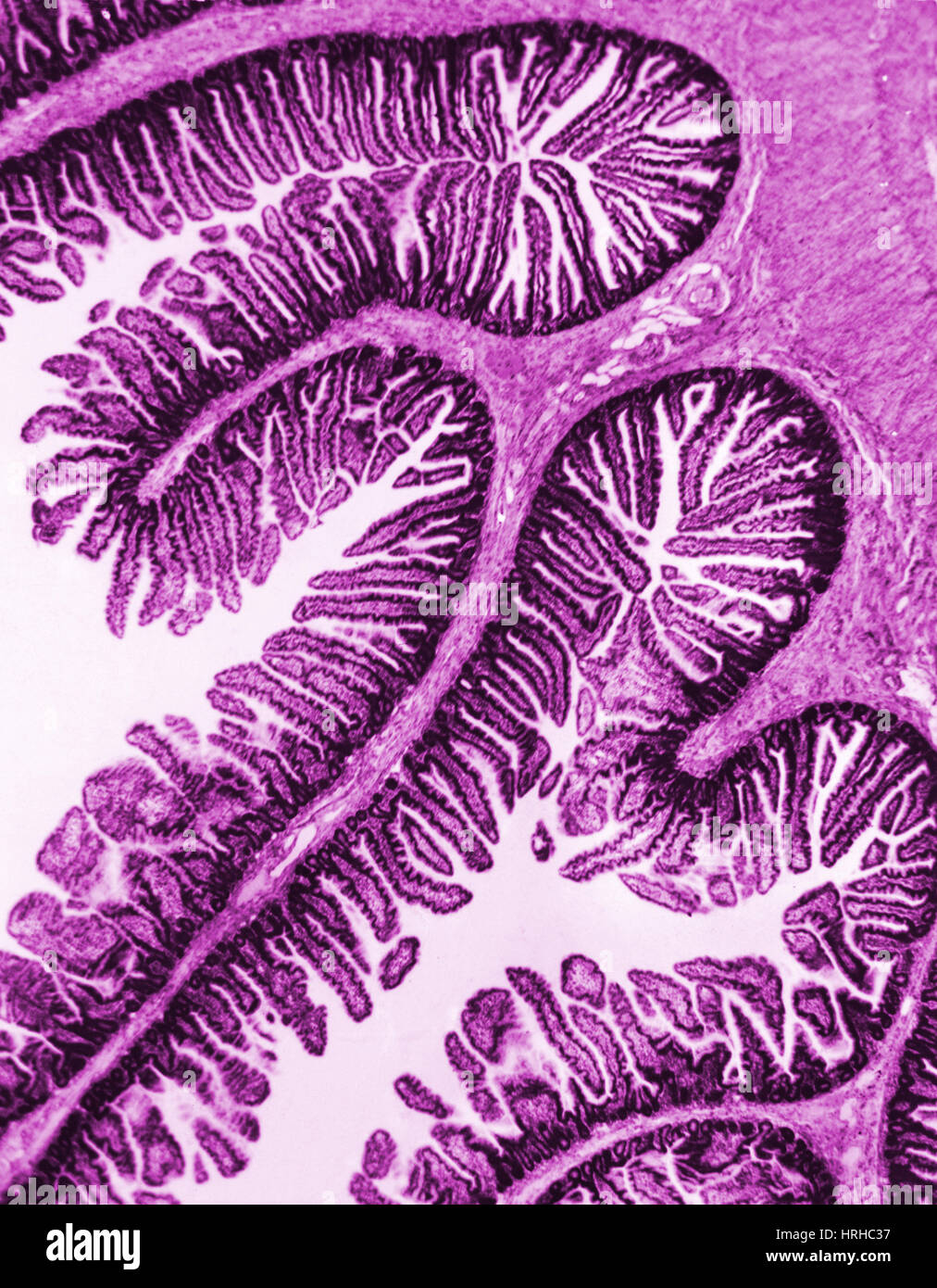 Villi small intestine micrograph hi-res stock photography and images ...