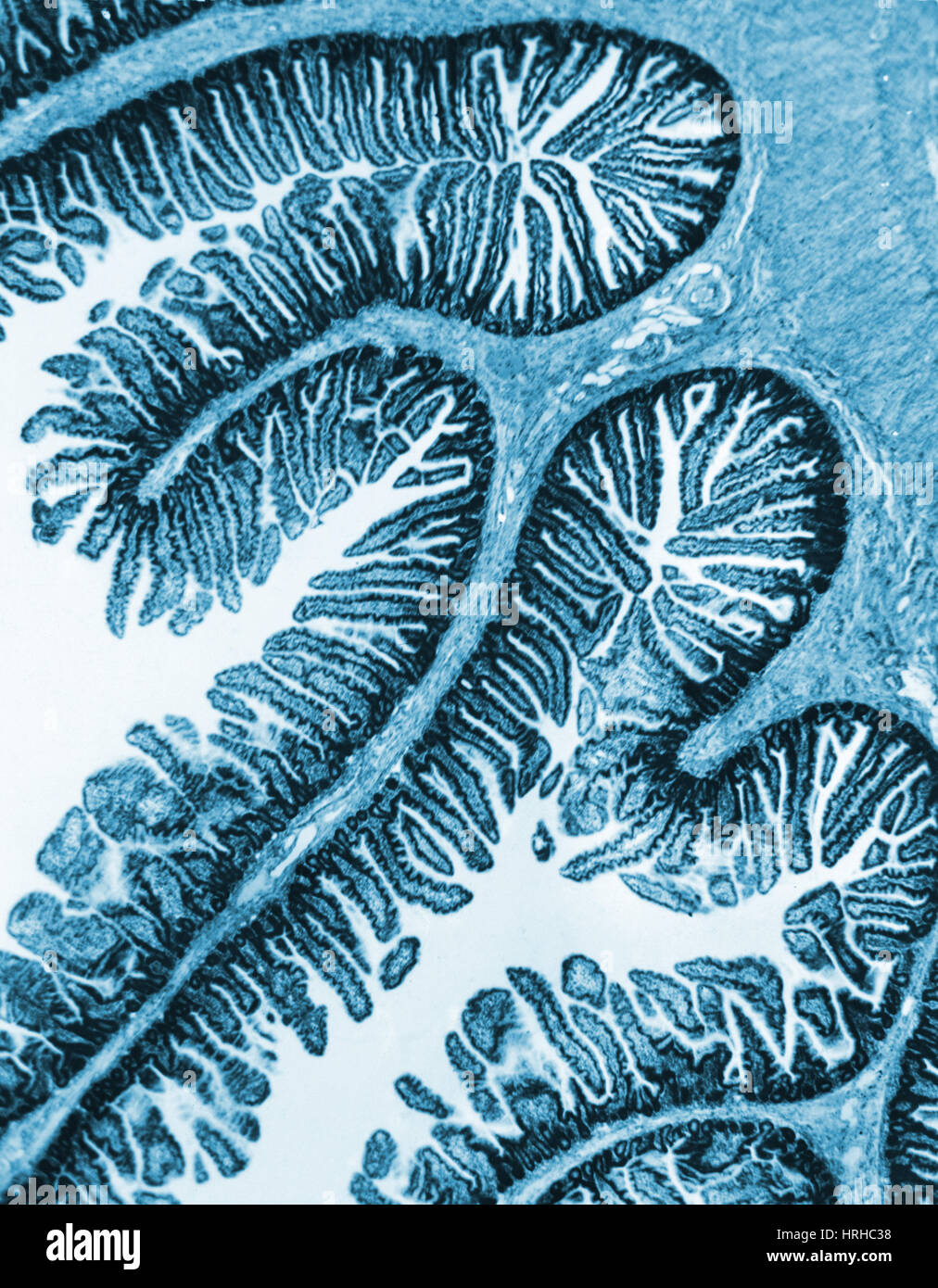 Villi small intestine micrograph hi-res stock photography and images ...