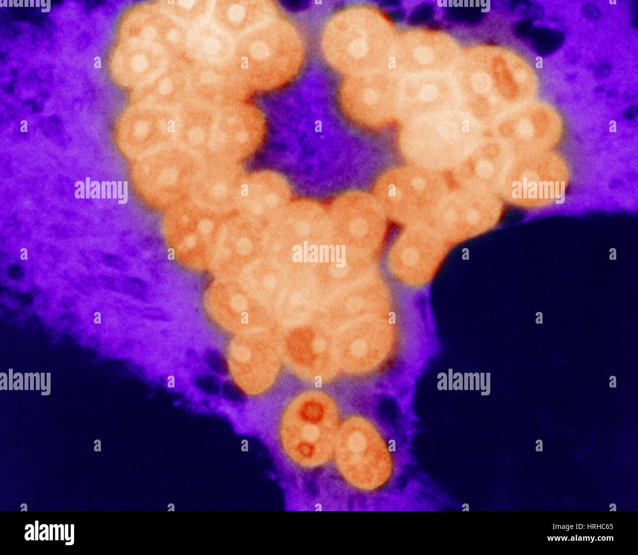 Measles virus micrograph hi-res stock photography and images - Alamy
