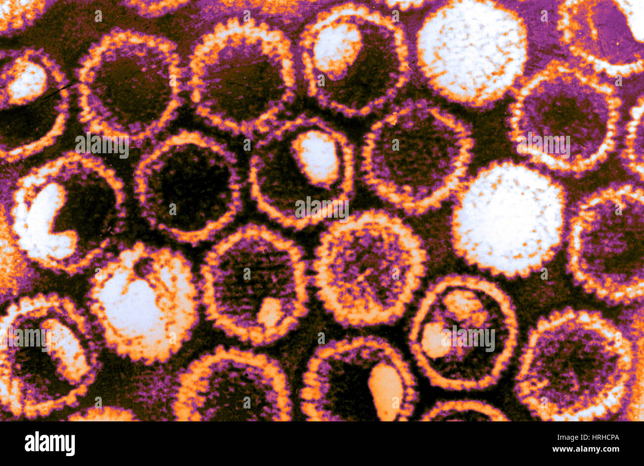 Tem membrane hi-res stock photography and images - Alamy