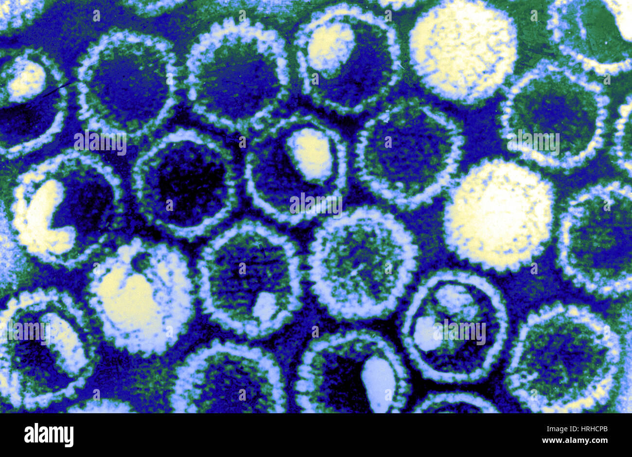 Herpes virus tem hi-res stock photography and images - Alamy