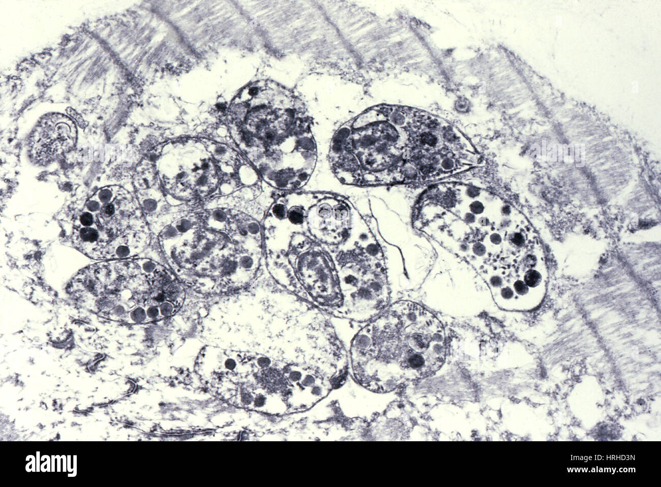 Endodyogeny hi-res stock photography and images - Alamy