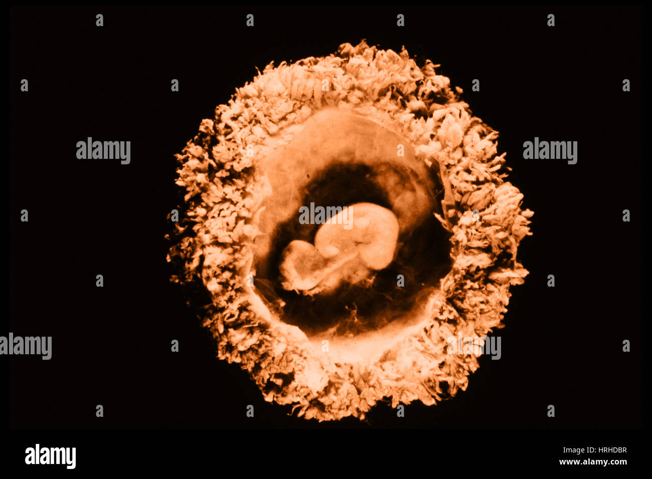 Amniotic egg hi-res stock photography and images - Alamy