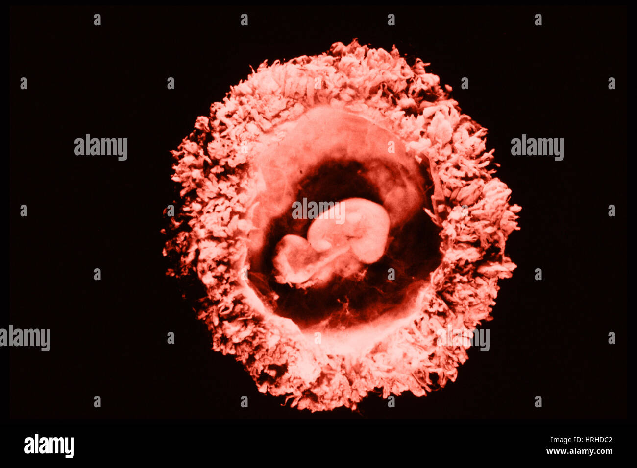 Wombs hi-res stock photography and images - Alamy