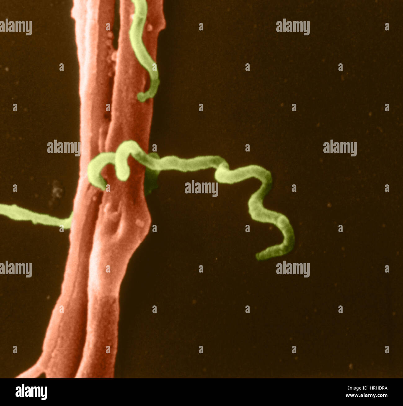 Treponema pallidum syphilis bacterium hi-res stock photography and ...