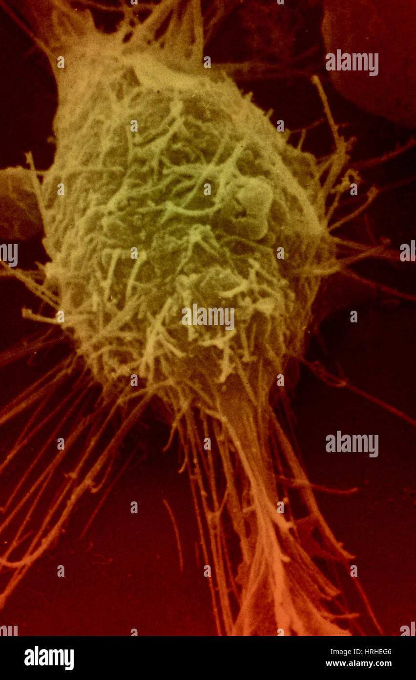 Neuroblastoma cells hi-res stock photography and images - Alamy