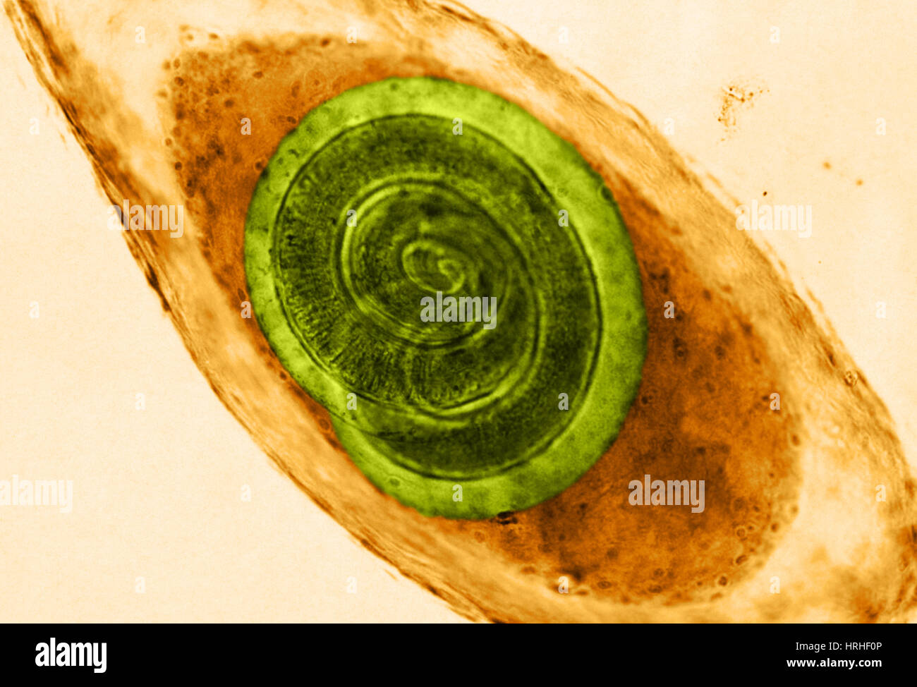 Light Micrograph Of Muscle With Encysted Trichinella Microscopic