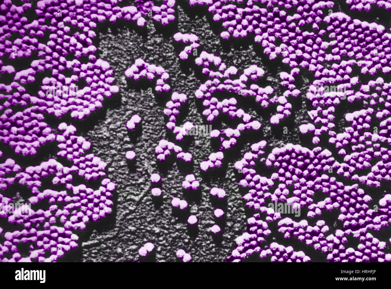 Polio virus micrograph hi-res stock photography and images - Alamy