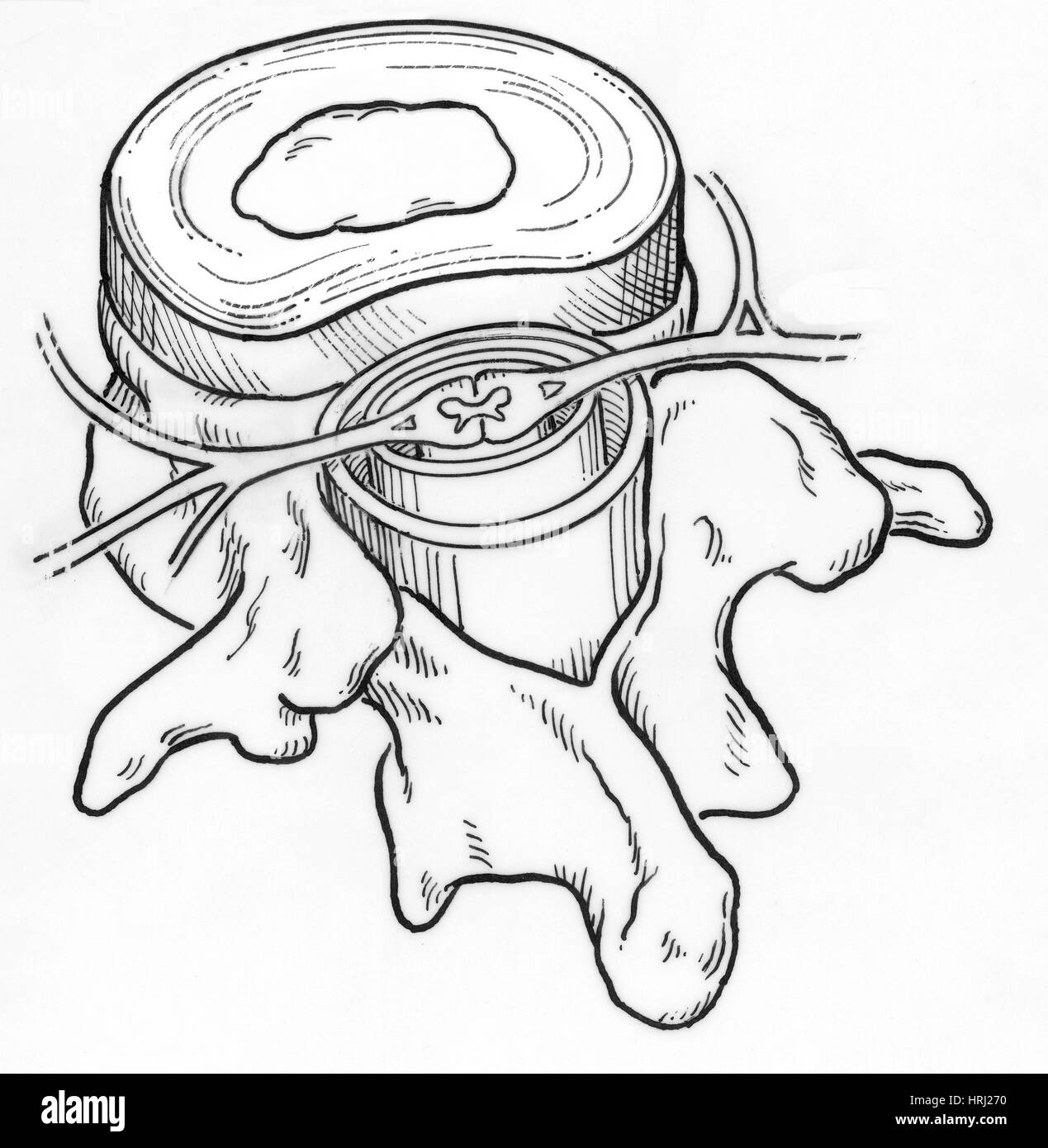 Illustration of Spinal Disk Stock Photo - Alamy