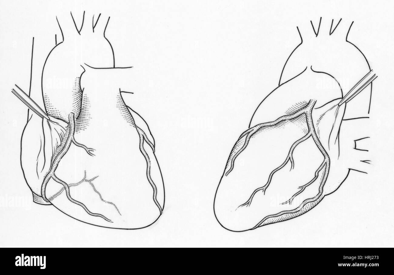 Arteries human body Black and White Stock Photos & Images - Alamy