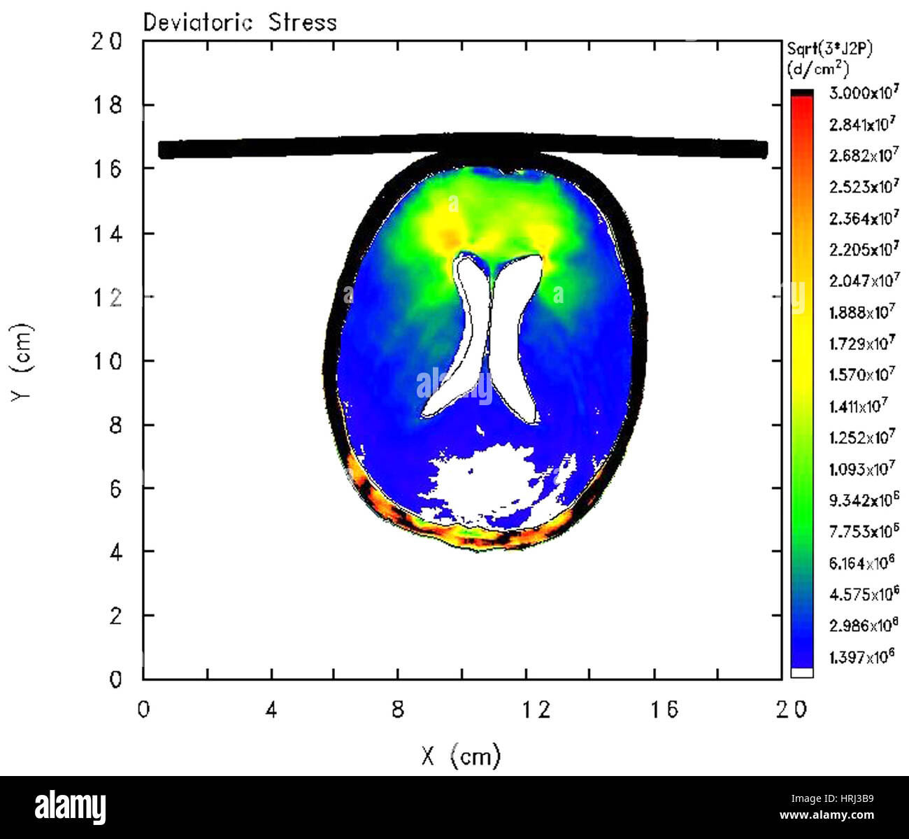 Modeling Brain Injury Stock Photo - Alamy