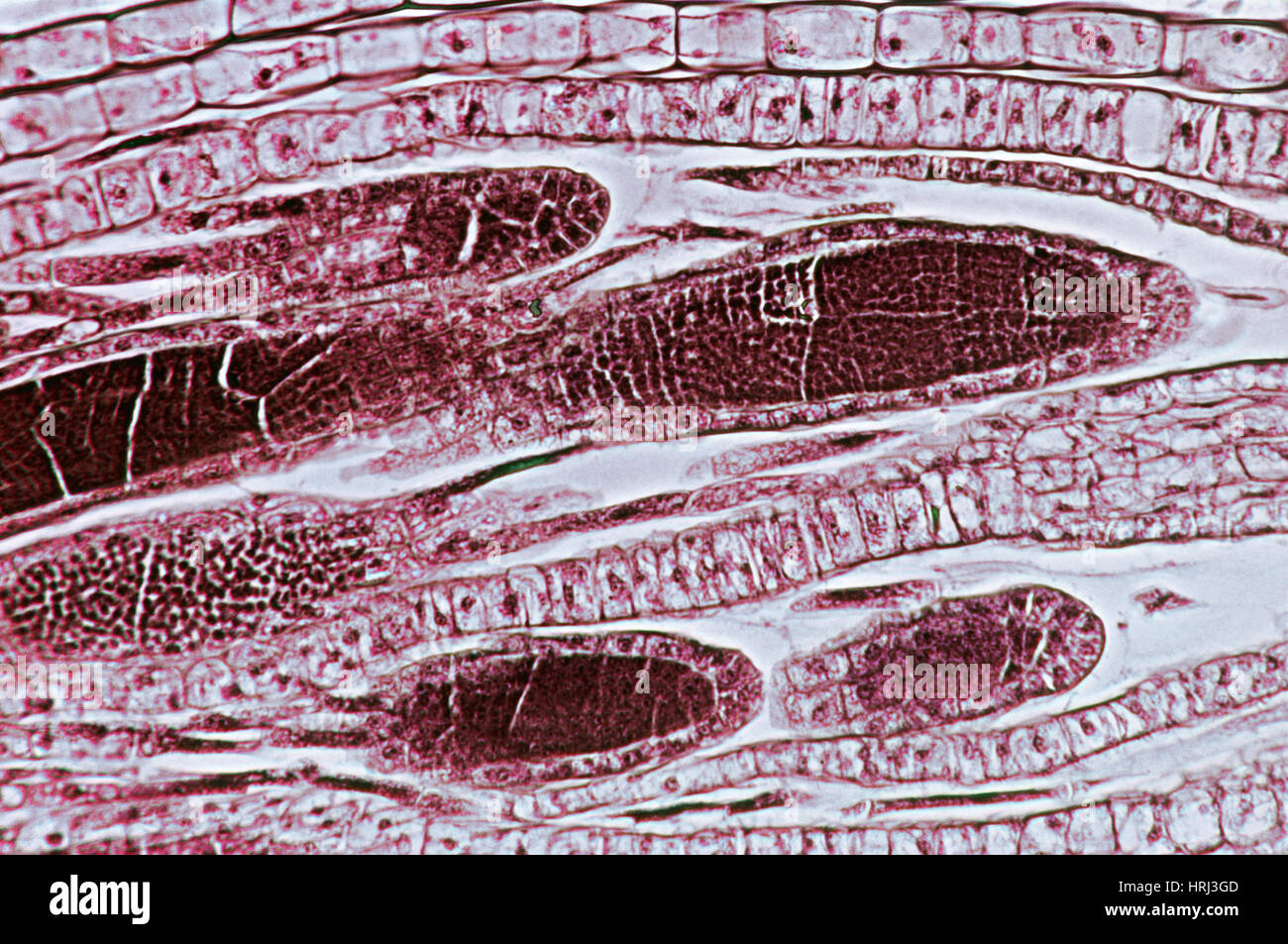 Mnium Archegonium Of Slide