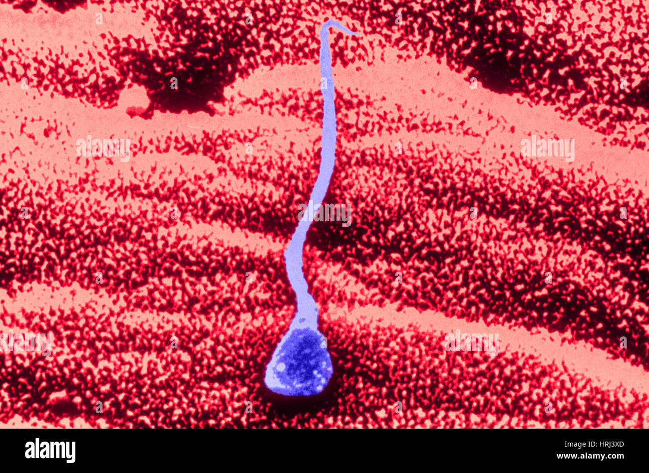 Human sperm cells micrograph hi-res stock photography and images - Alamy