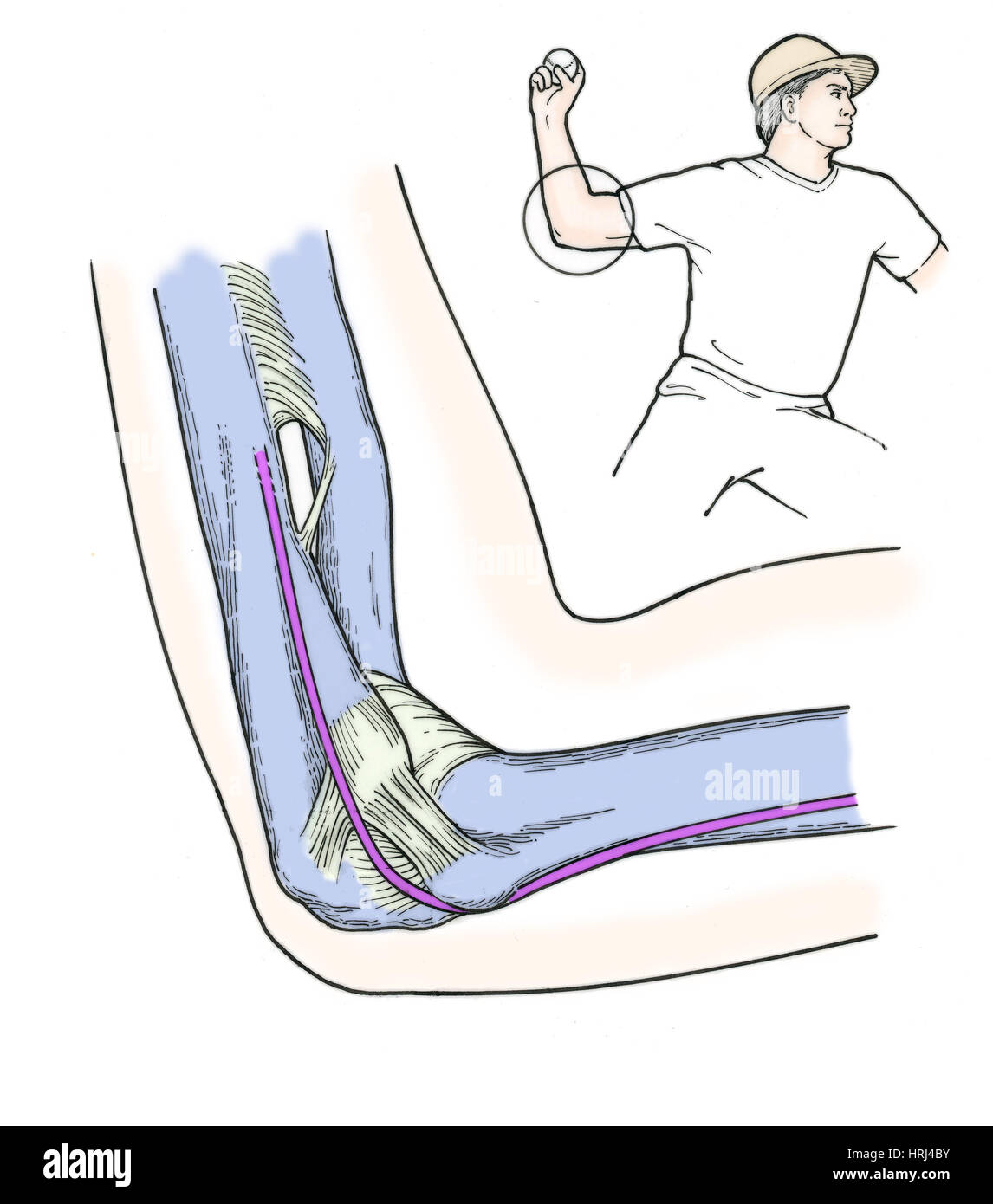 Medial epicondyle hi-res stock photography and images - Alamy