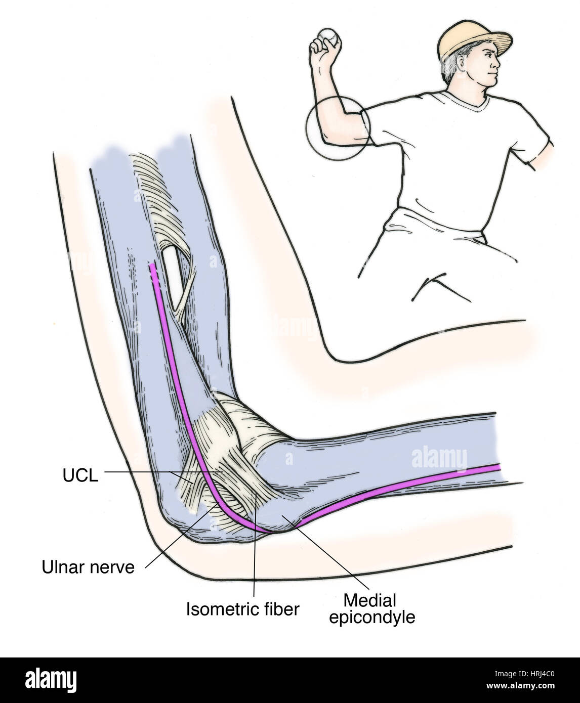 Medial epicondyle hi-res stock photography and images - Alamy