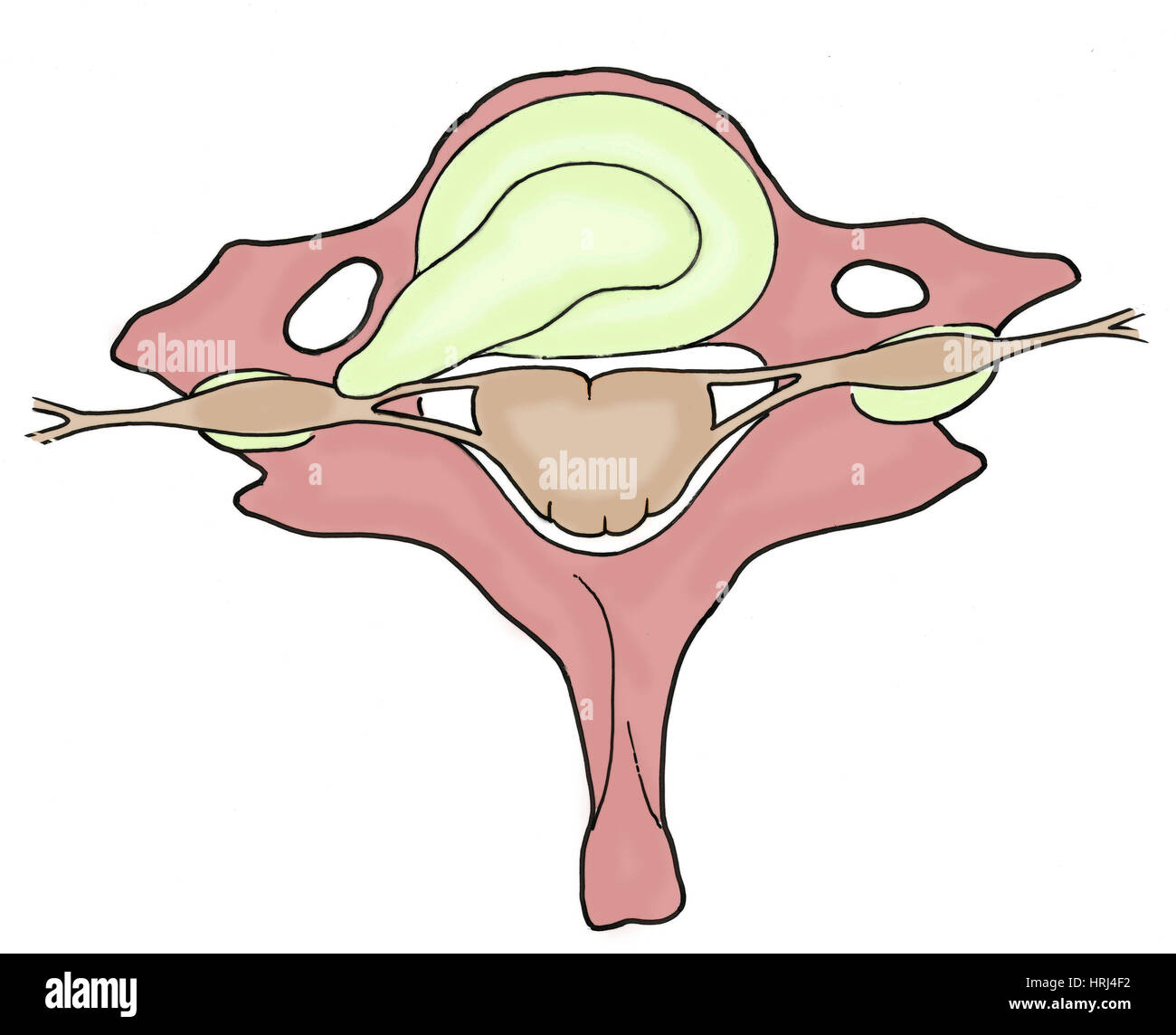 Illustration of Herniated Spinal Disk Stock Photo - Alamy