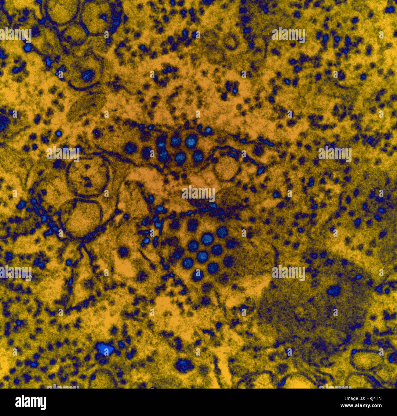 Dengue Virus, TEM Stock Photo - Alamy