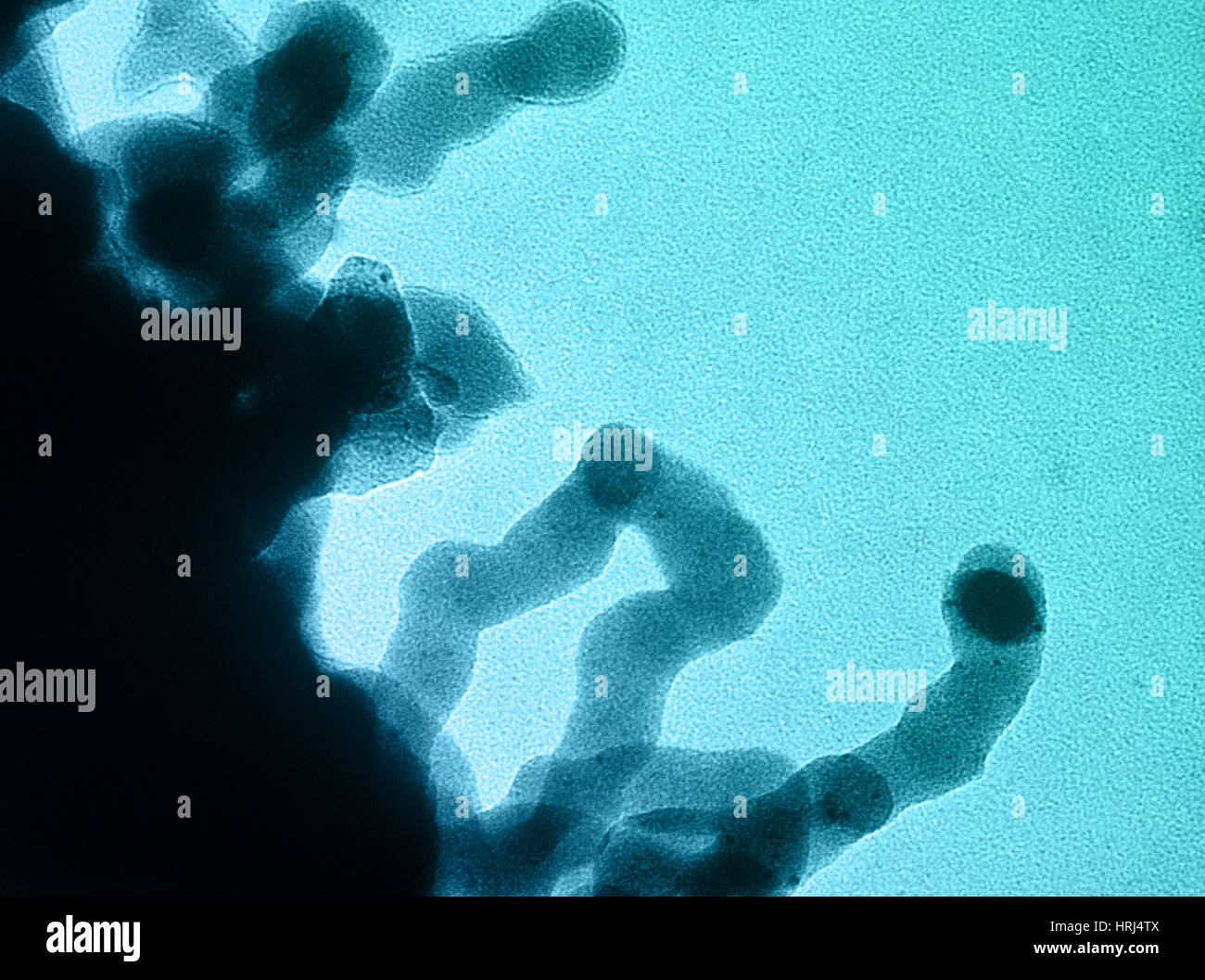 Chromatin micrograph hi-res stock photography and images - Alamy