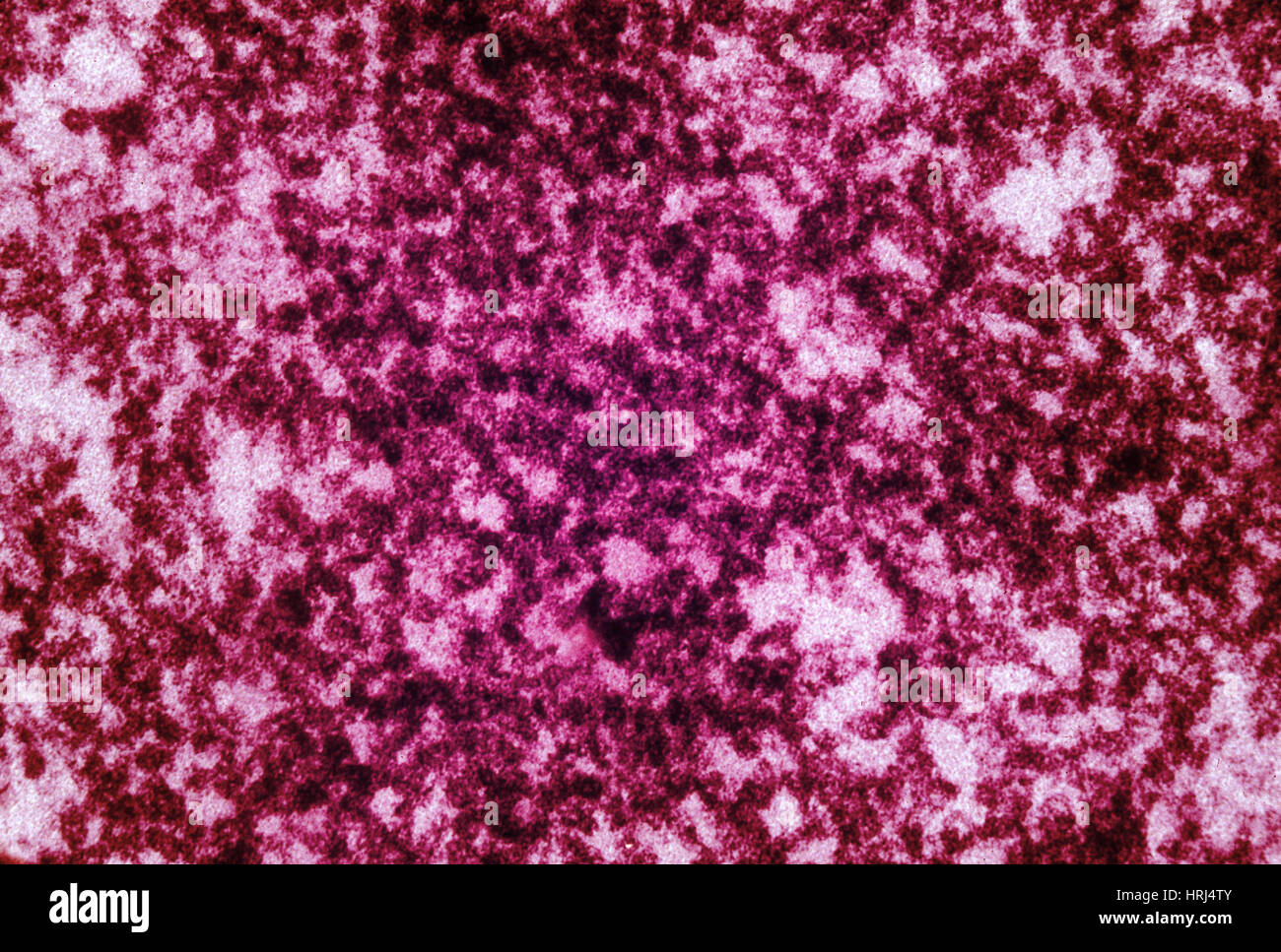 Chromatin Fibers, TEM Stock Photo - Alamy