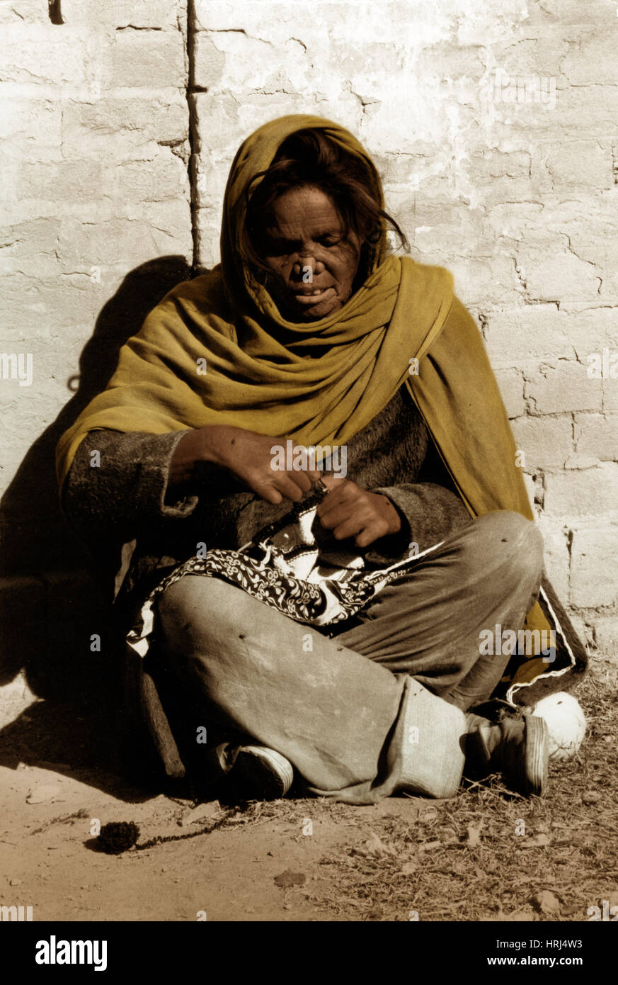 Leprosy infection hi-res stock photography and images - Alamy