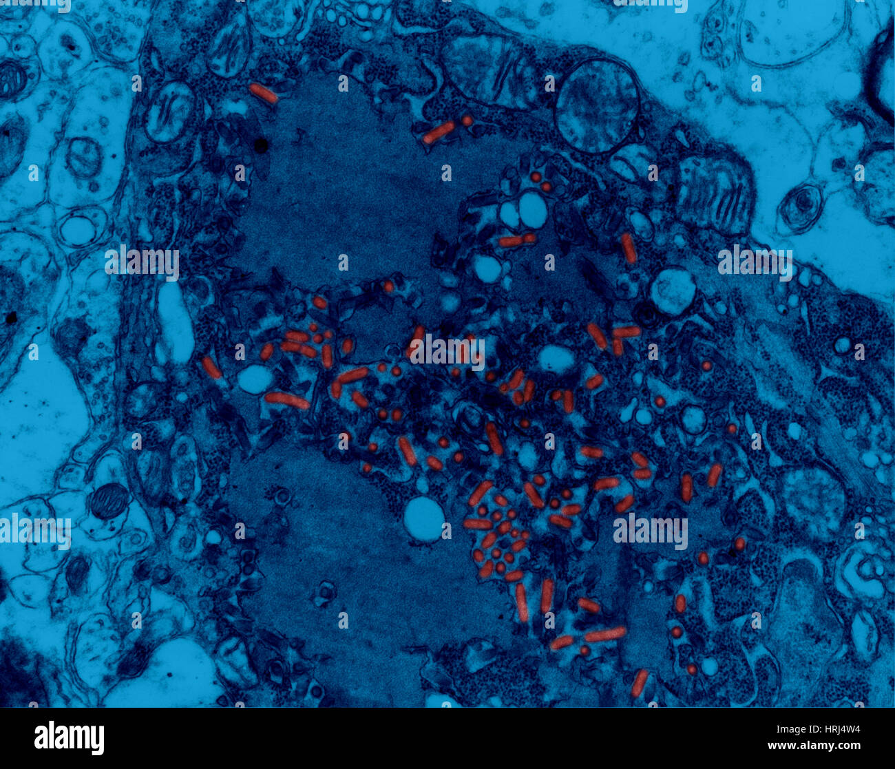 Rabies virus pathology hi-res stock photography and images - Alamy