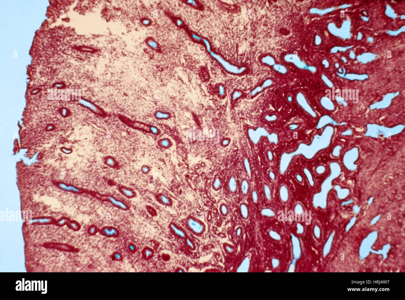 Uteruses hi-res stock photography and images - Alamy