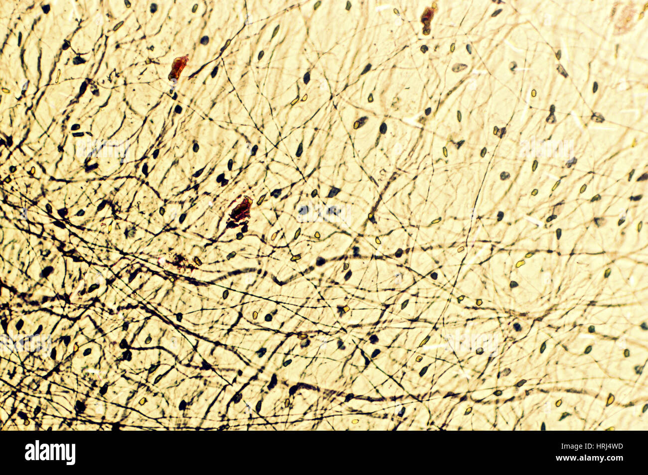 Loose connective tissues hi-res stock photography and images - Alamy