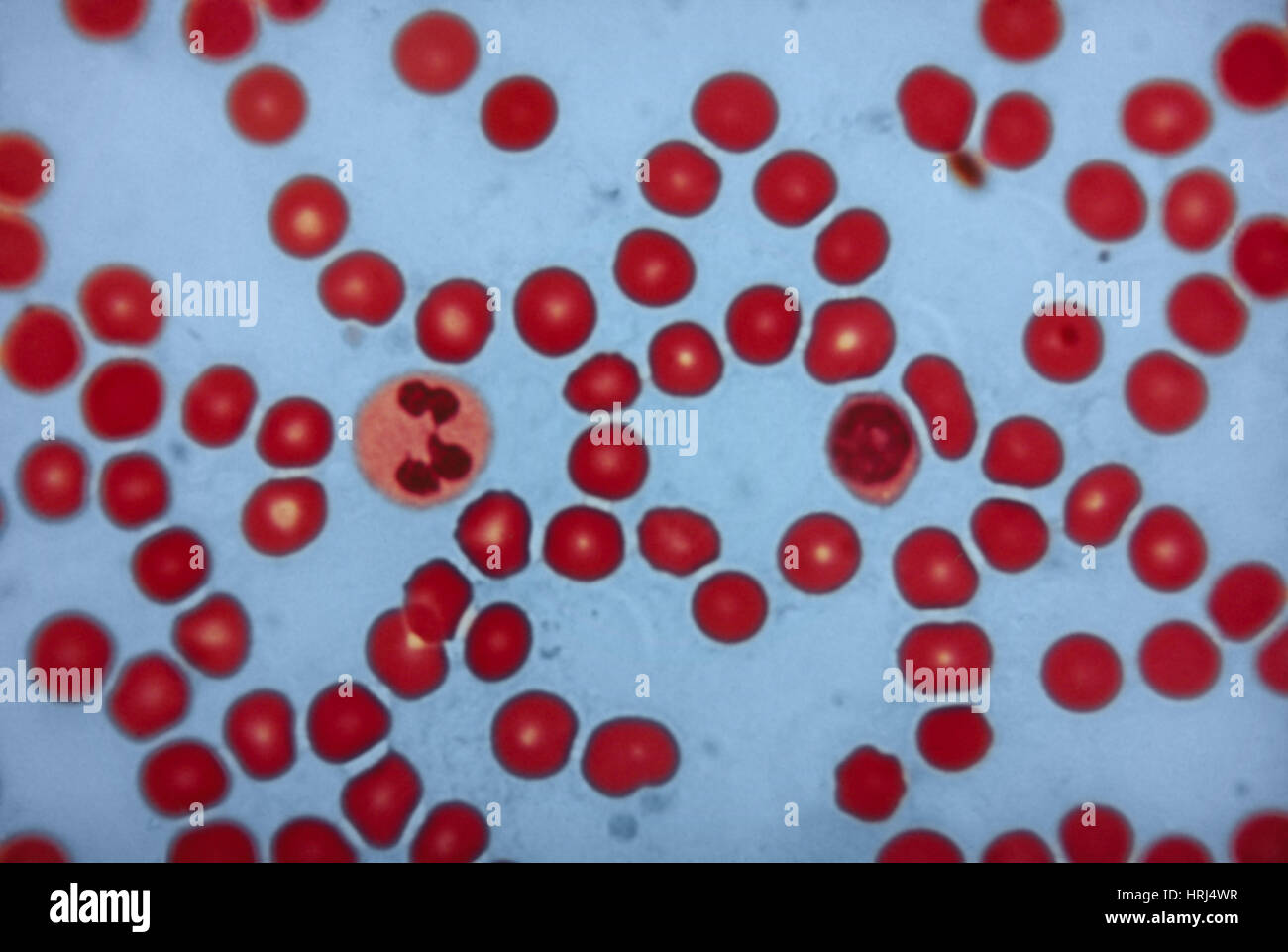 Red and White Blood Cells (LM Stock Photo - Alamy