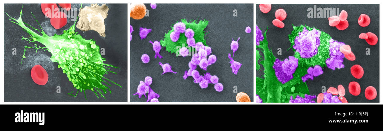Cancer Cell Death Sequence, SEM Stock Photo - Alamy