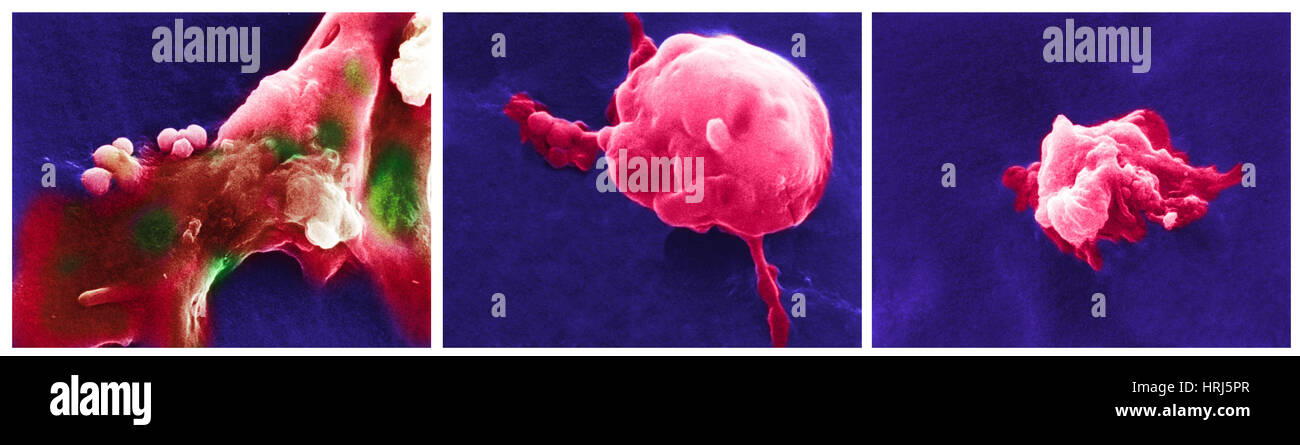 Cancer cell death sequence hi-res stock photography and images - Alamy