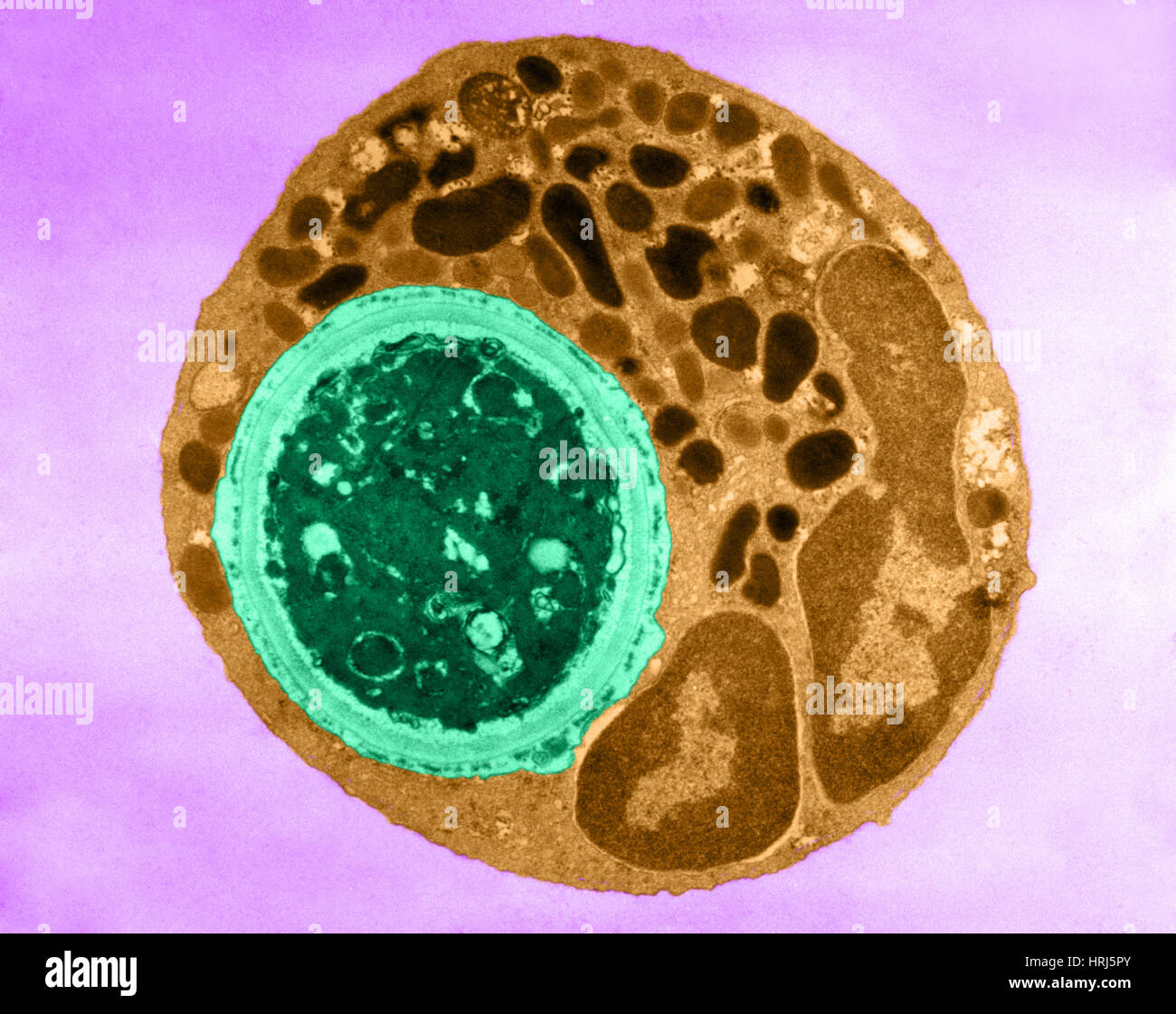 Lymphocyte Digesting Yeast Cell, TEM Stock Photo - Alamy