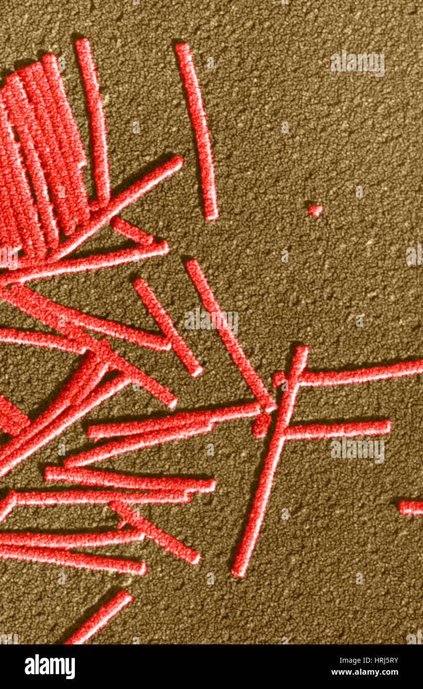 Tobacco mosaic virus micrograph hi-res stock photography and images - Alamy