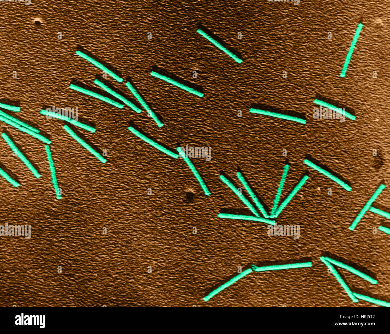 Tobacco mosaic virus micrograph hi-res stock photography and images - Alamy