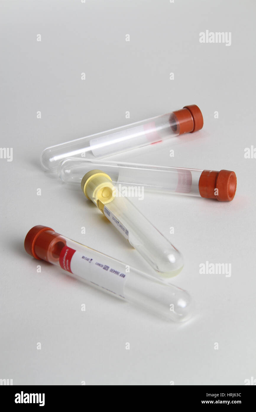 Yellow cap test tube hi-res stock photography and images - Alamy