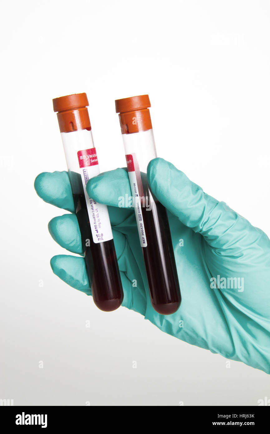 Blood samples testing screening hi-res stock photography and images - Alamy